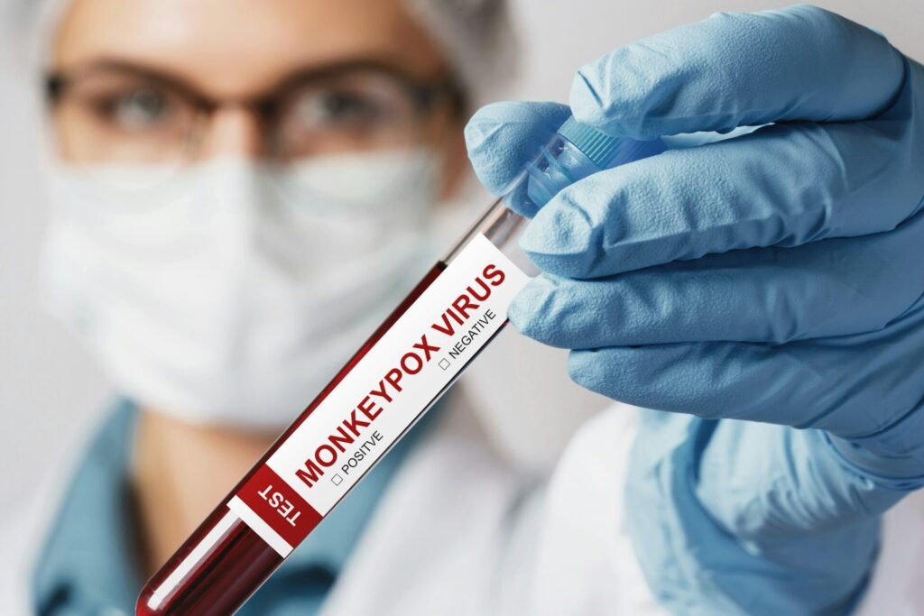 Aegis Sciences Corporation Now Performs Monkeypox Testing - Aegis ...